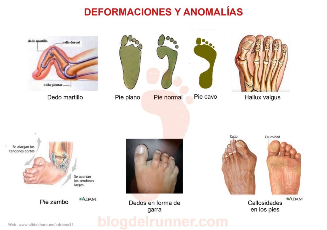 Runner, ¿conoces tus pies? – Blog del Runner